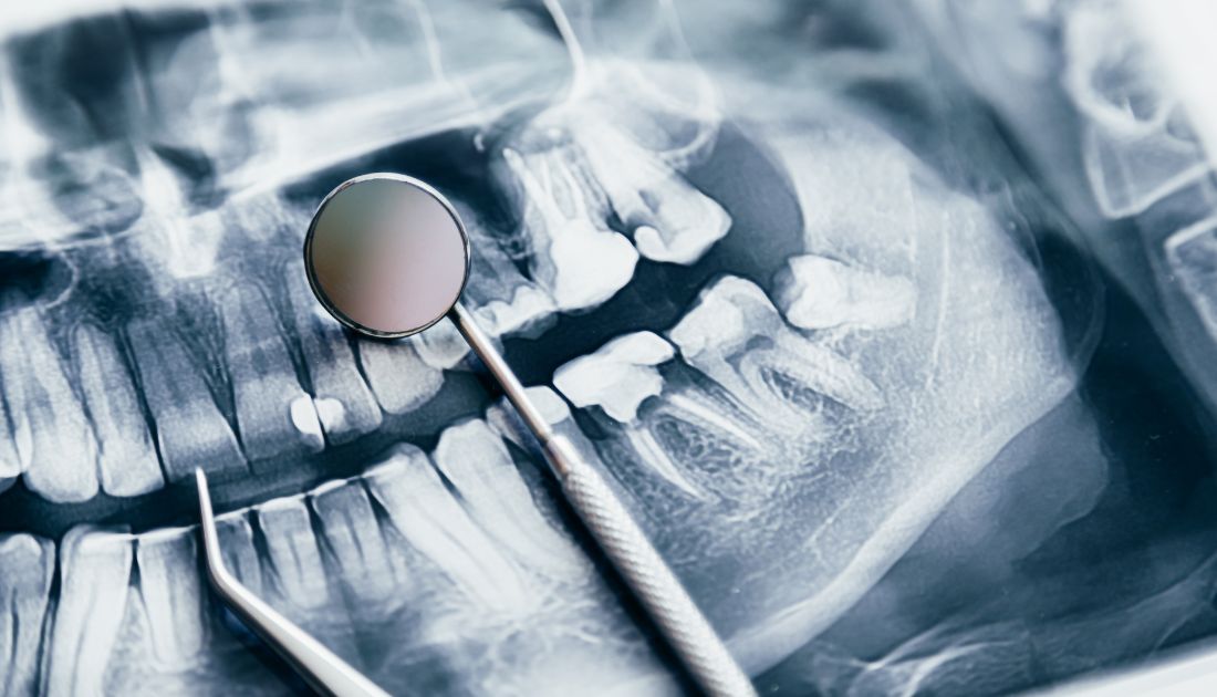 What You Need to Know About Buying a Dental Practice | Panacea